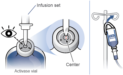 Dosing & Administration Guidelines for Activase® (alteplase)